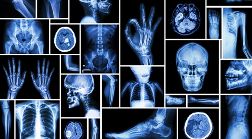 الأشعة السينية ما بين الفوائد والمخاطر - ويب طب